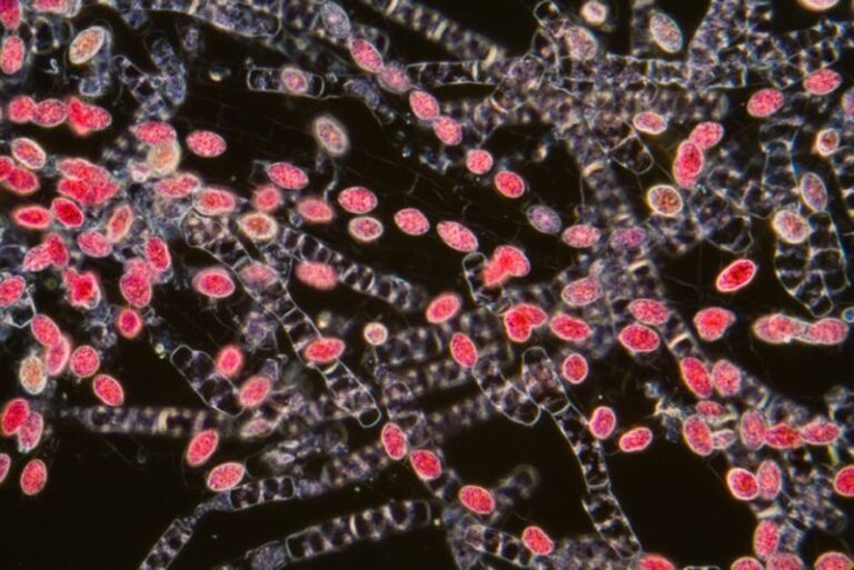 Observing Spirogyra Under Microscope » Microscope Club